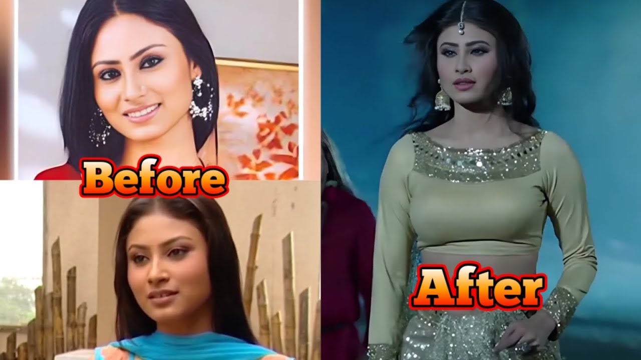 Mouni Roy's Plastic Surgery - YouTube