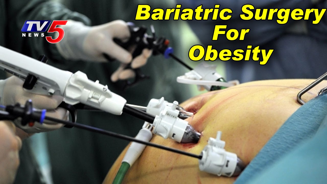 Bariatric Surgery For Severe Obesity | LivLife Hospitals | Health File ...