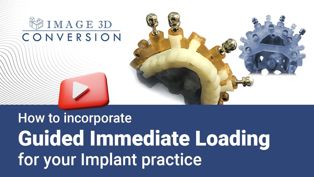 How to incorporate Guided Immediate Loading for your Implant practice? - YouTube