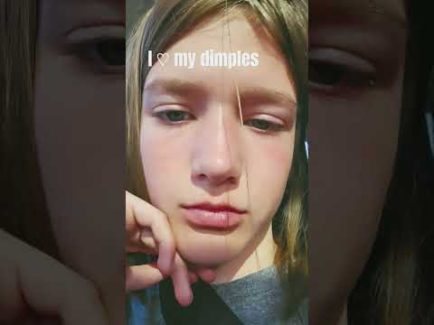 dimples - YouTube