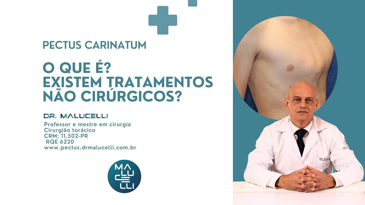 Pectus CARINATUM: o que são e como ocorrem? - YouTube