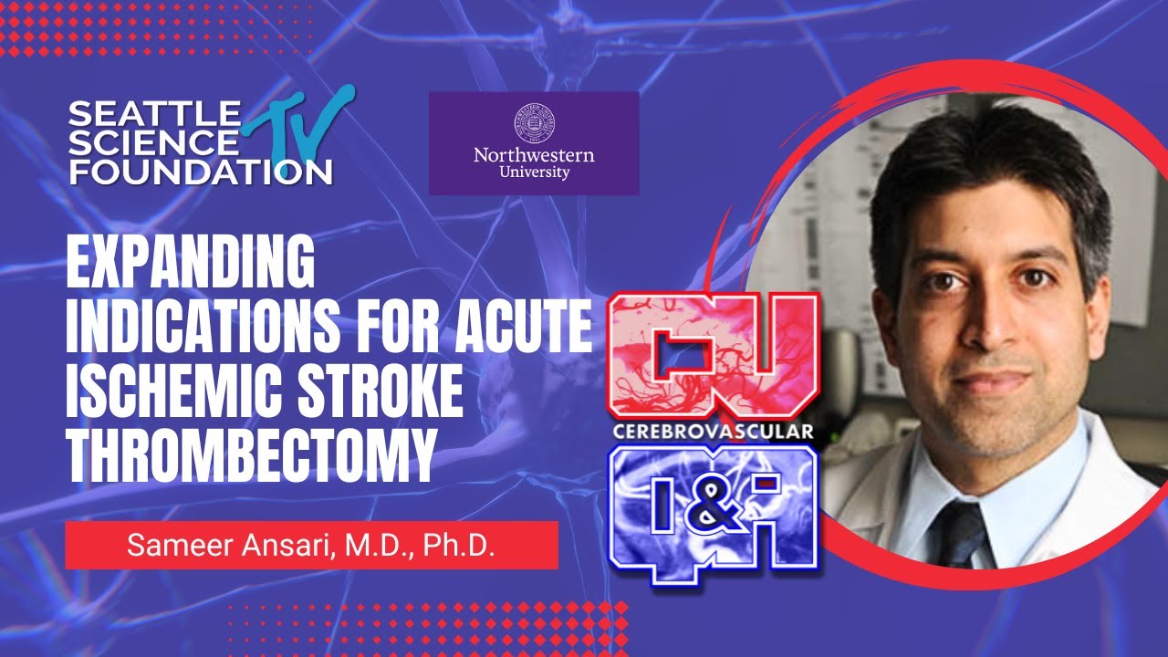 Expanding Indications for Acute Ischemic Stroke Thrombectomy – Sameer Ansari, MD - YouTube