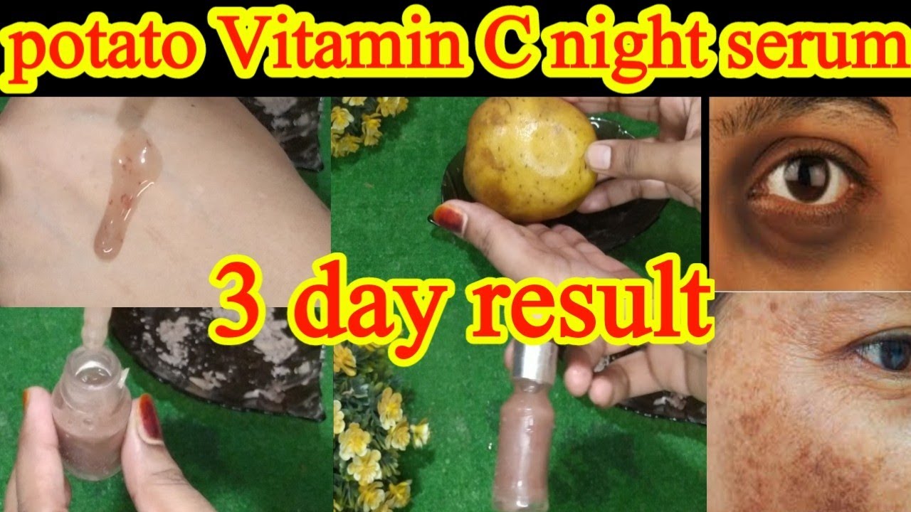 Potato Homemade Vitamin C whitening Serum|| pigmentation remove||dark ...