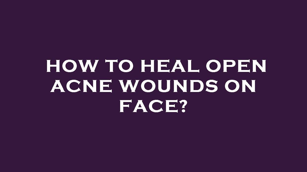 How to heal open acne wounds on face? - YouTube