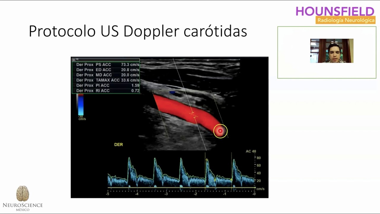 Conceptos basicos de ultrasonografia parte 2 - YouTube