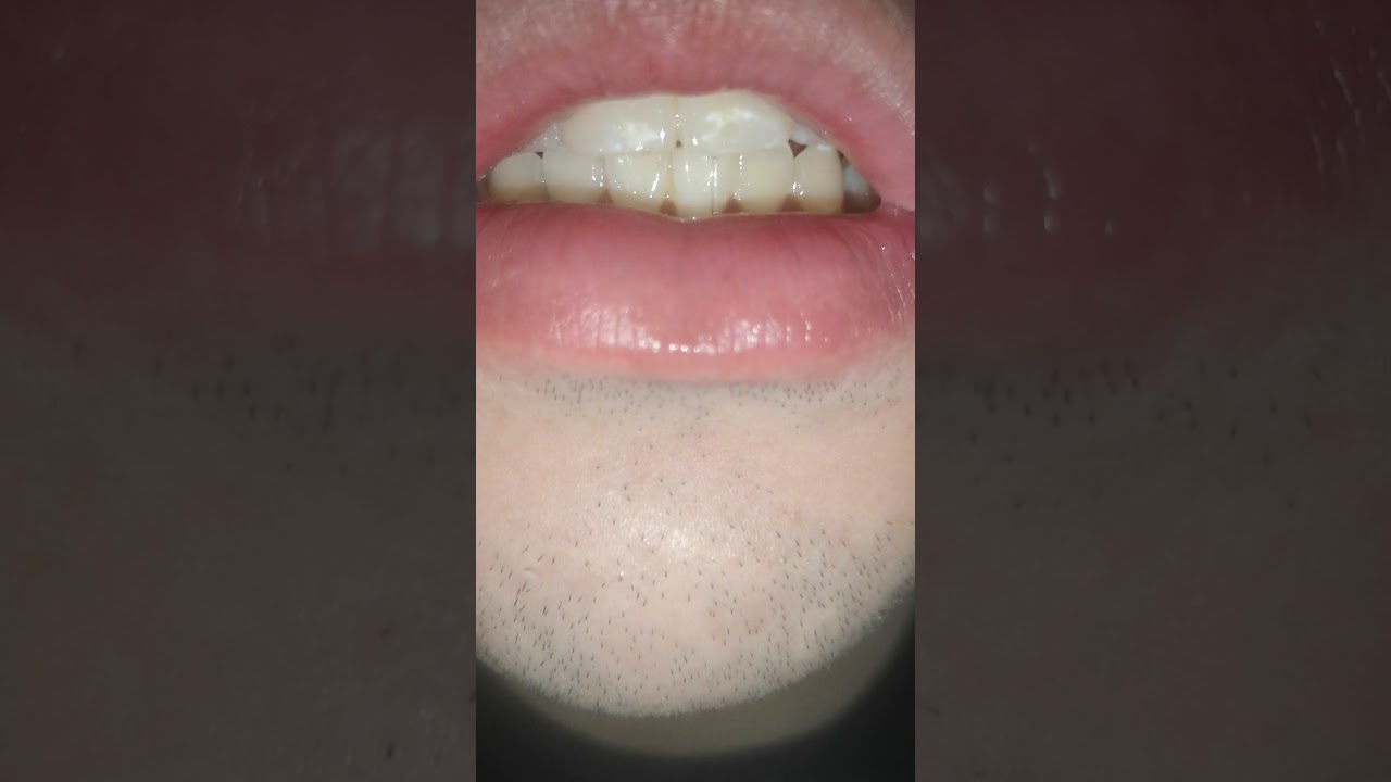 Uvula boy - YouTube