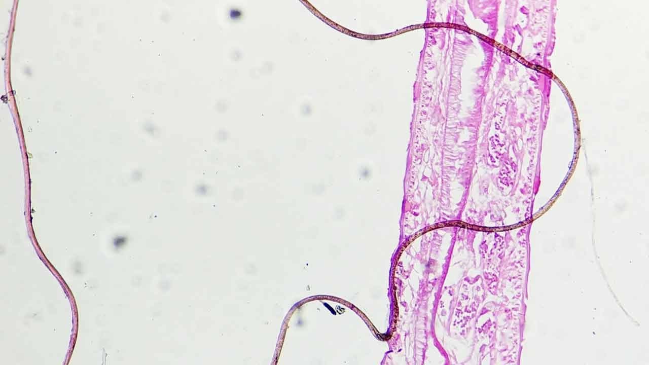 Liver Fluke Under the Microscope - YouTube