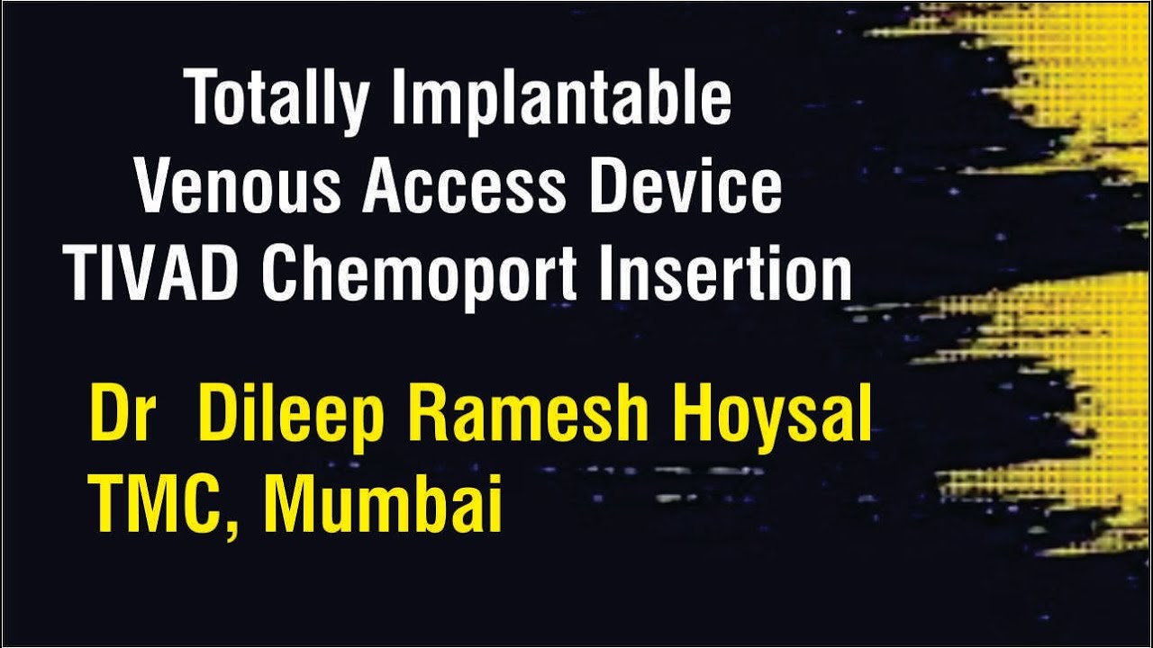Totally Implantable Venous Access Device TIVAD Chemoport Insertion, Dr ...