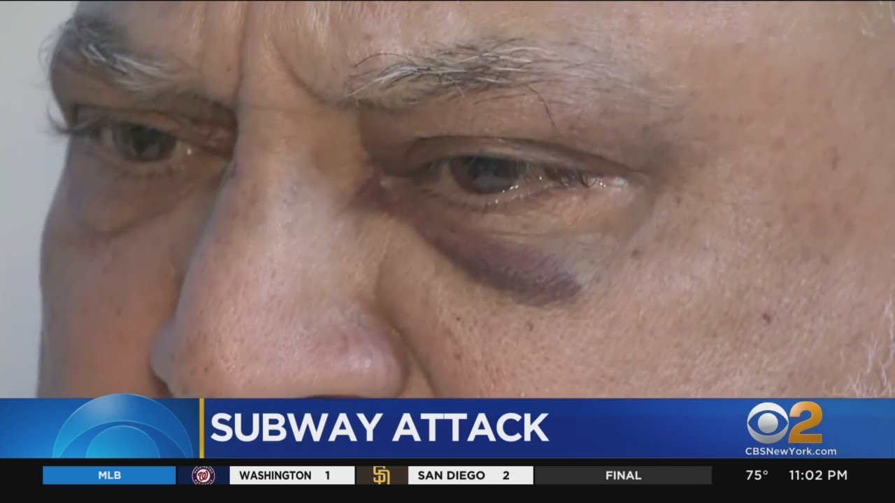 Victim speaks out about attack at Brooklyn subway station - YouTube