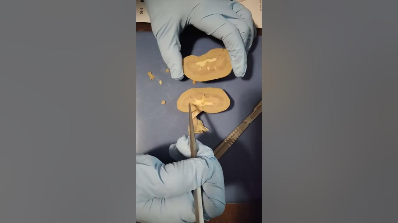 sheep kidney dissection - YouTube