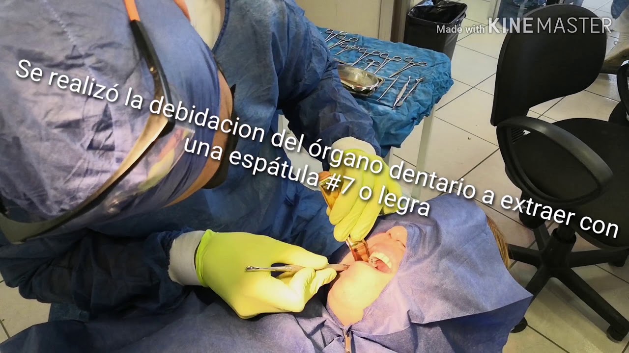 extracción simple une - YouTube