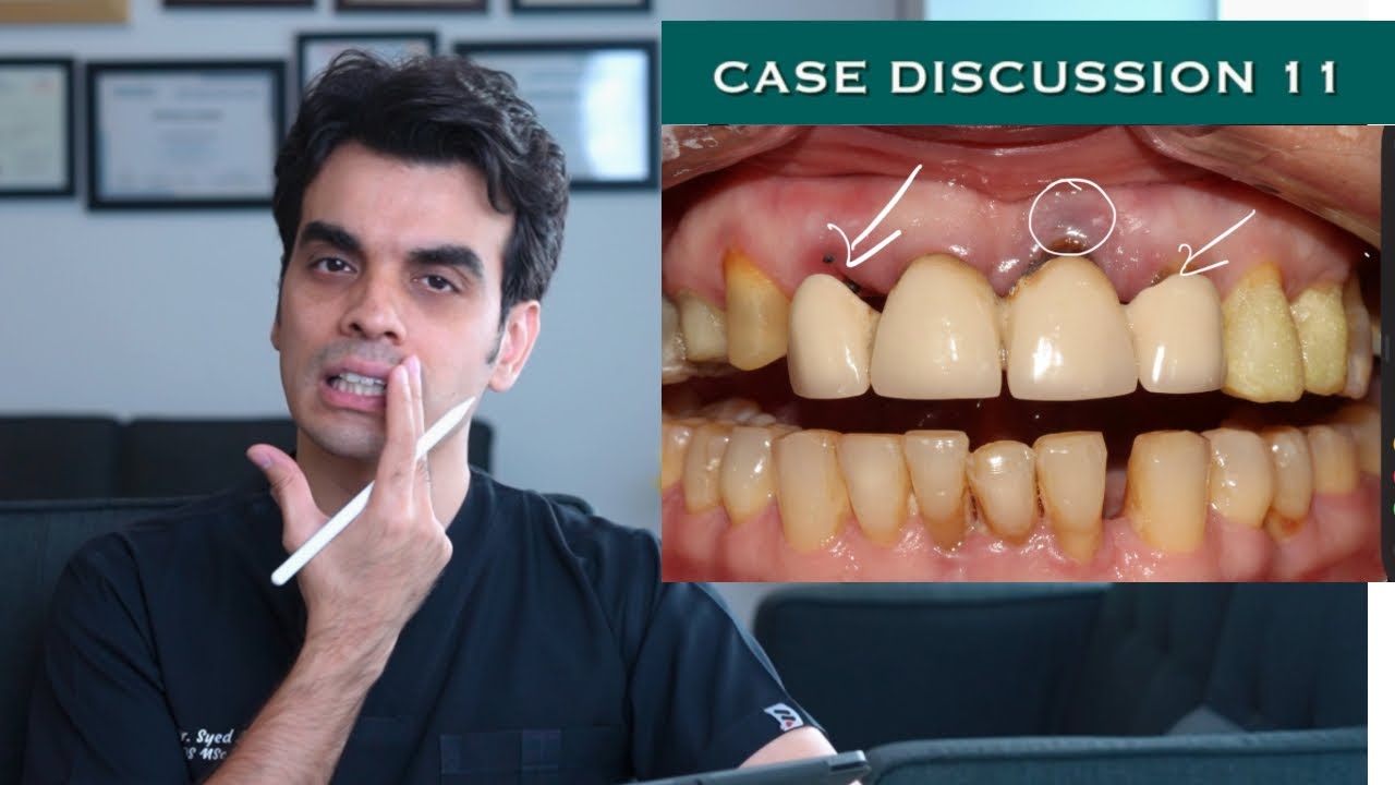 Case Discussion 11 - Replacing an Old Bridge - YouTube