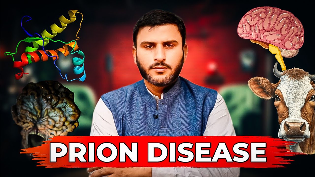 What is Prion Disease? - YouTube