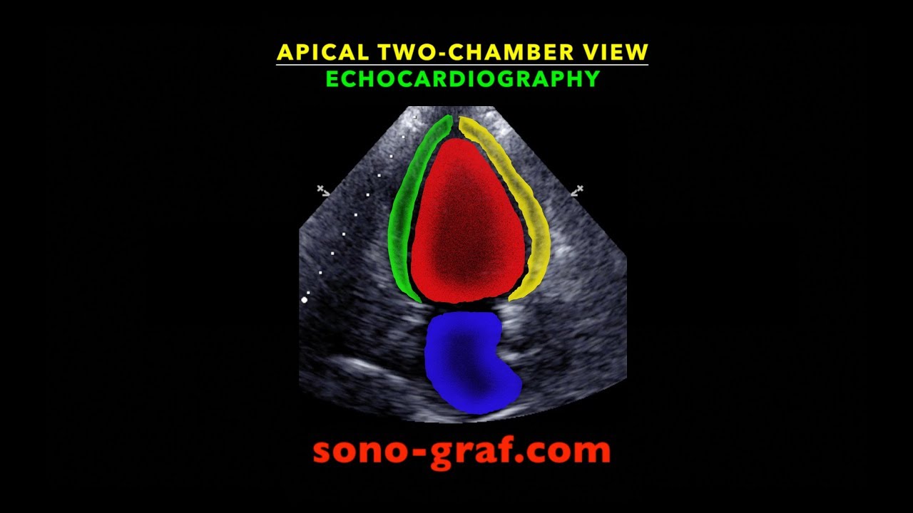 Echocardiography - Apical two chamber view - YouTube