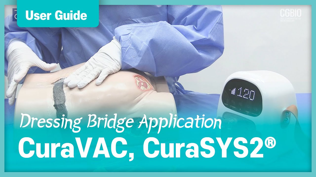 [WOUND] CGBIO CURASYS2 & CURAVAC Product Video - YouTube