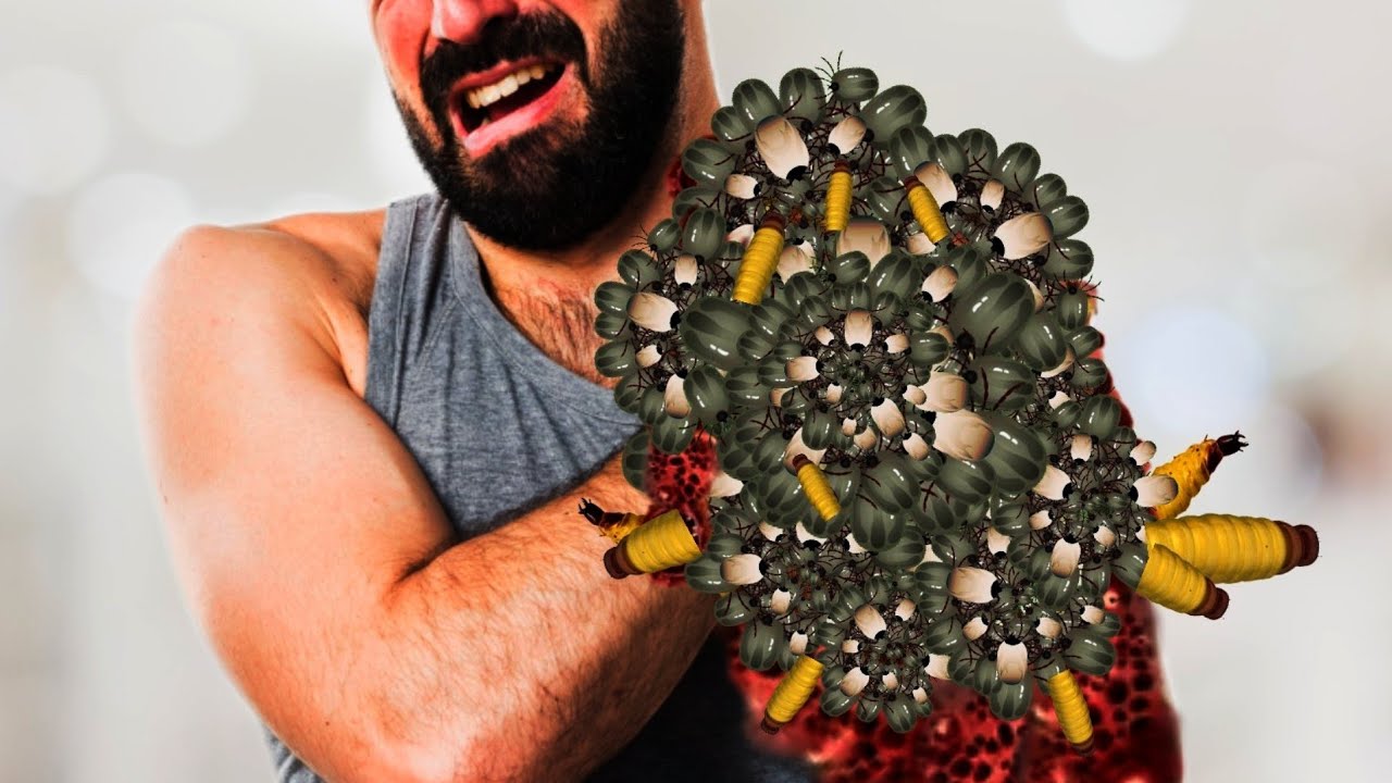 ASMR remove dog tick infected shoulder and hand | ASMR maggot removal ...