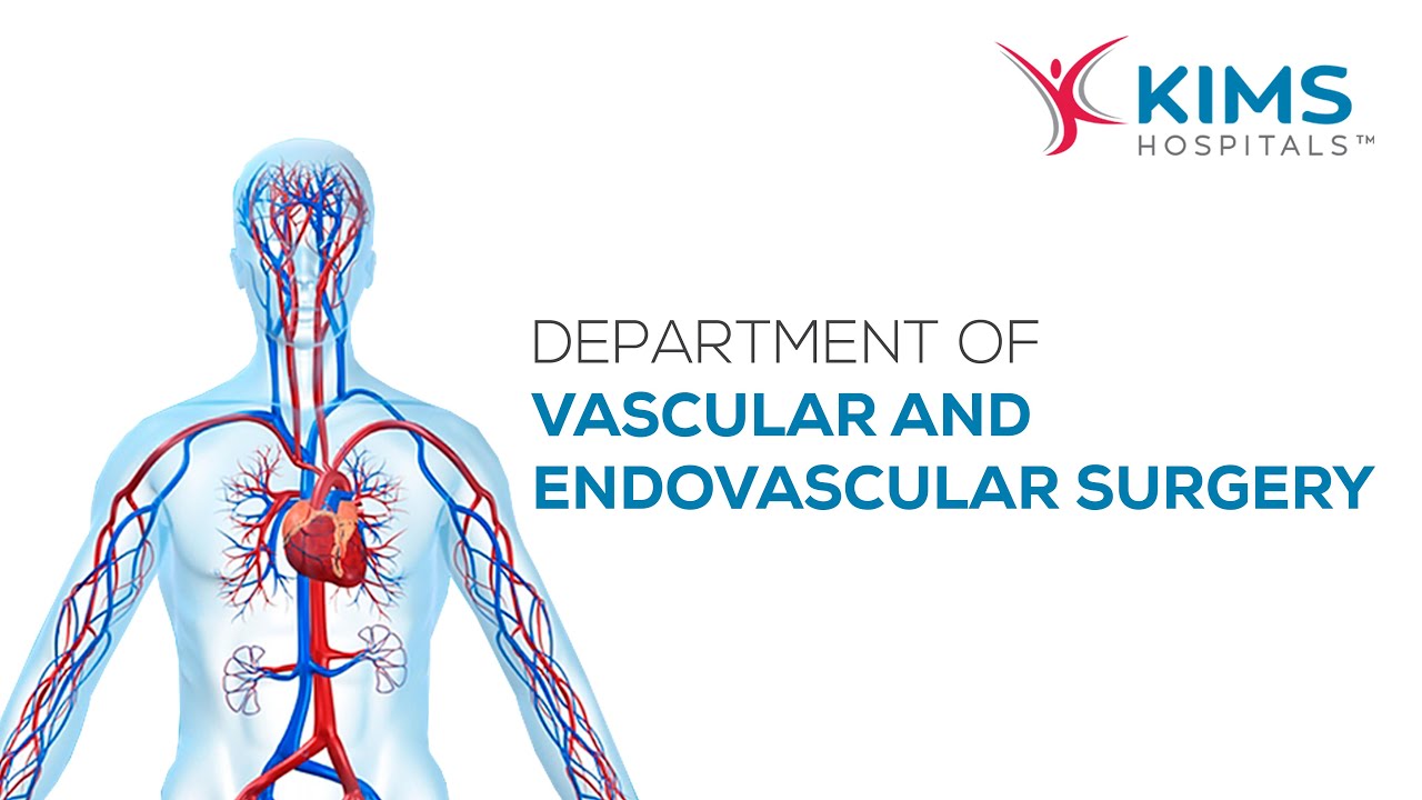 What Is Vascular Endovascular Surgery at Shelley Siegel blog
