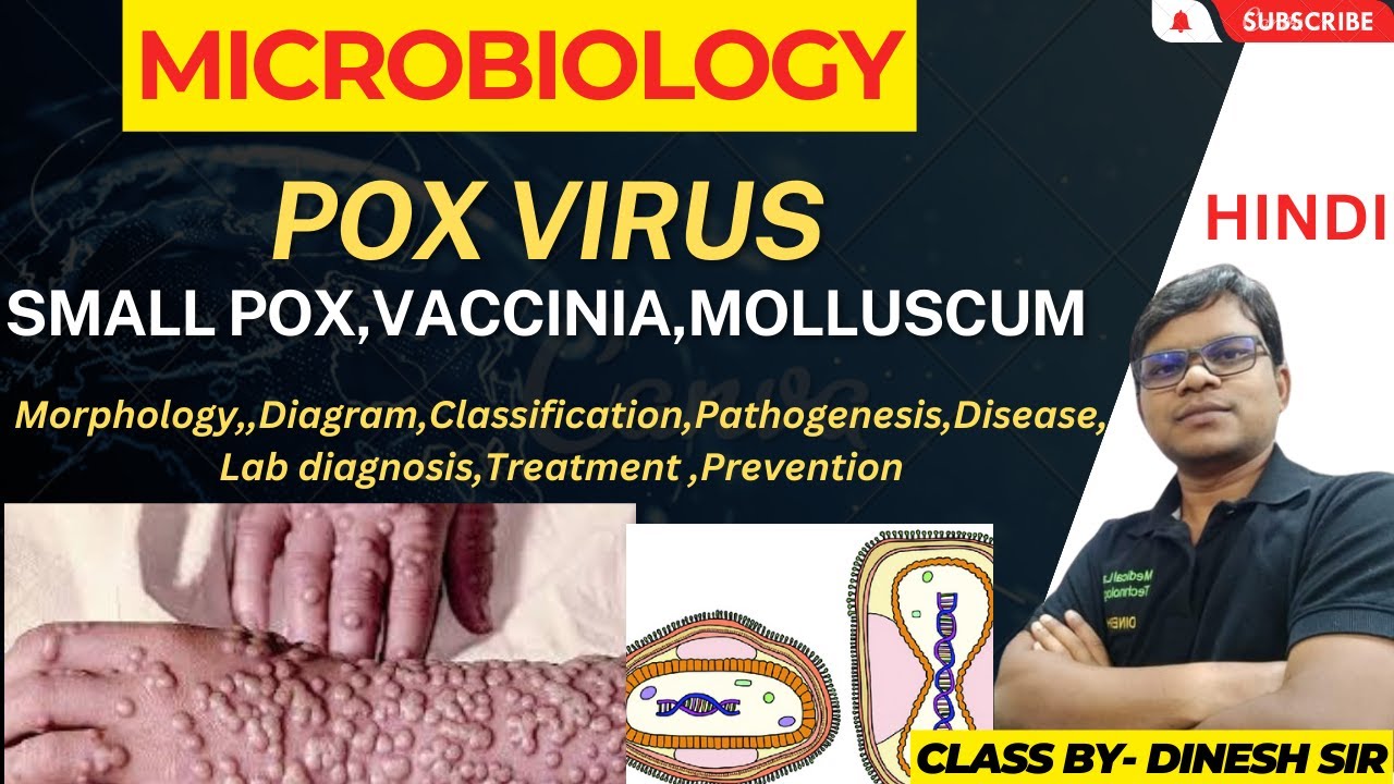 Pox Virus | Small Pox | Variola , Vaccinia ,Chickenpox | Molluscum ...