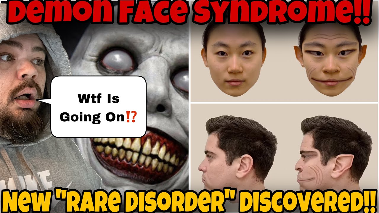SCARY! This Recently Discovered Condition Is Causing People To See ...
