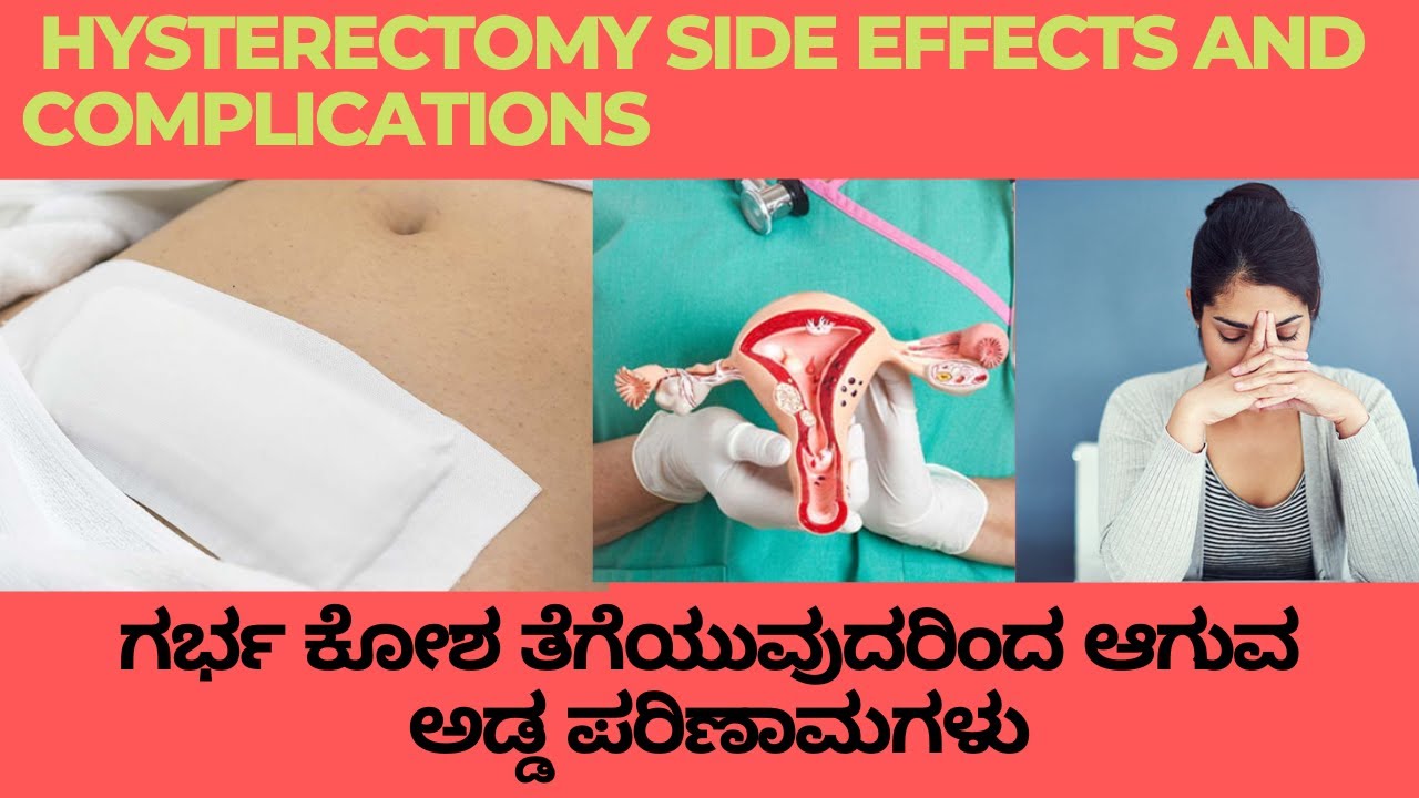 Side Effects Complications Of Hysterectomy Uterus Removal ಗರ್ಭ ಕೋಶ