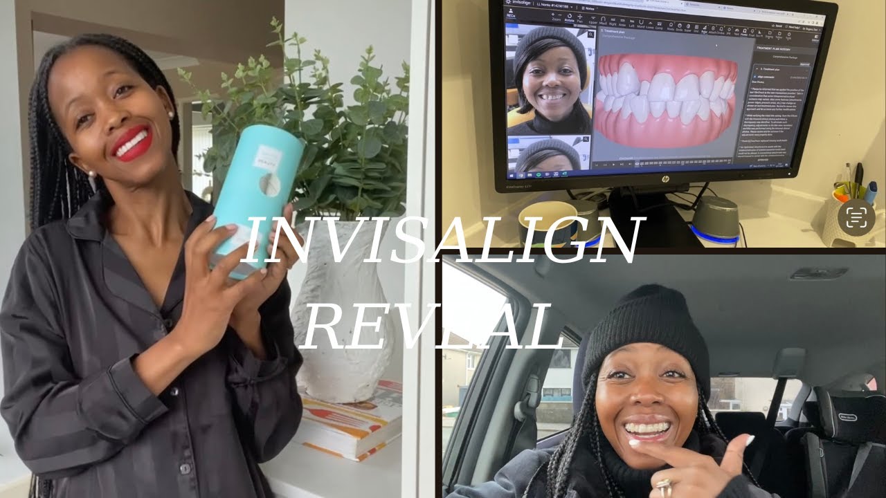 MY INVISALIGN JOURNEY| THE FINAL REVEAL - YouTube