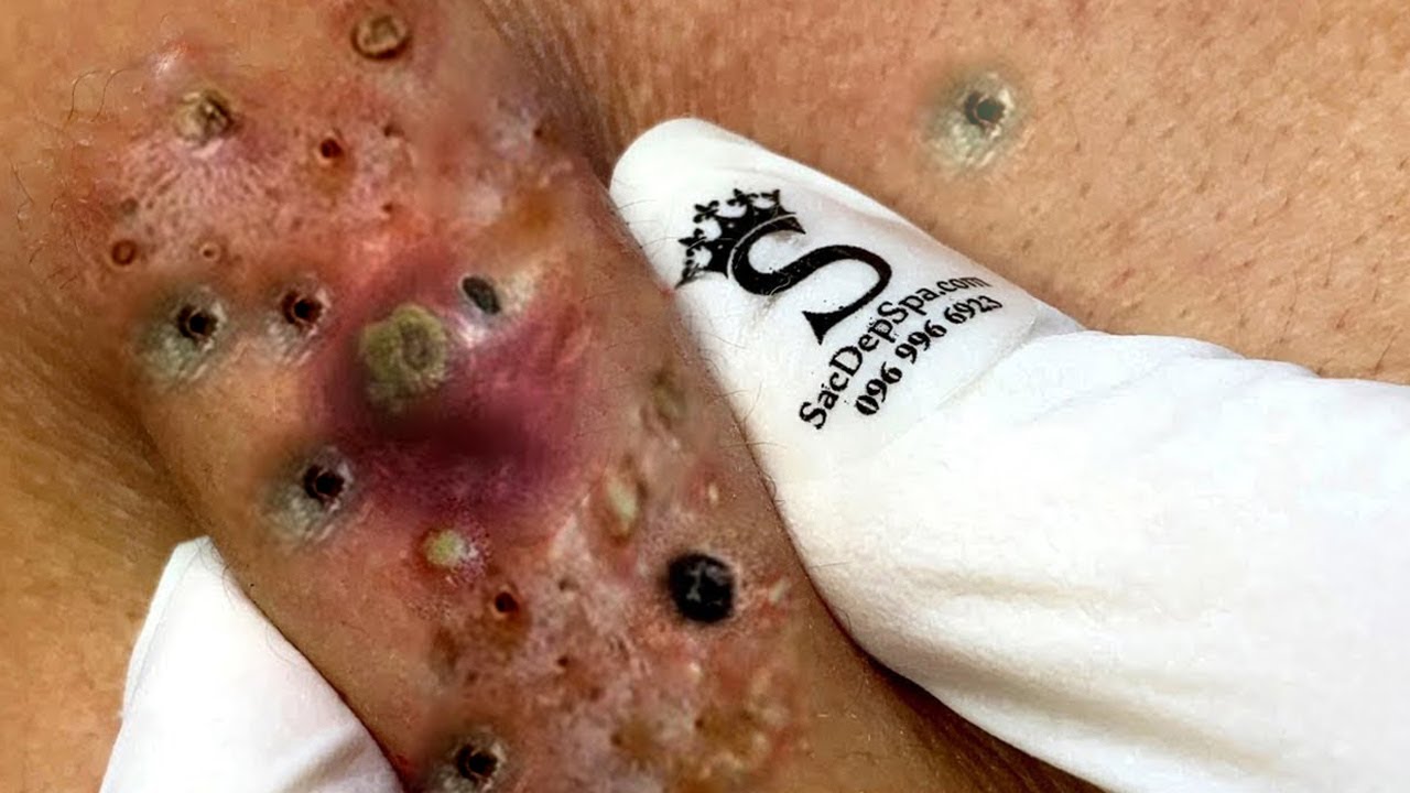 𝐑𝐞𝐟𝐫𝐞𝐬𝐡 𝐘𝐨𝐮𝐫 𝐅𝐚𝐜𝐞 𝐖𝐢𝐭𝐡 𝐒𝐤𝐢𝐧 𝐂𝐚𝐫𝐞 #𝟓𝟑𝟔𝟎349 - YouTube