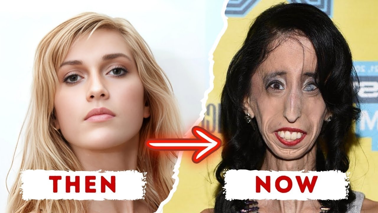 The Secret Behind Perfect Beauty Celebrities Addicted to Plastic ...