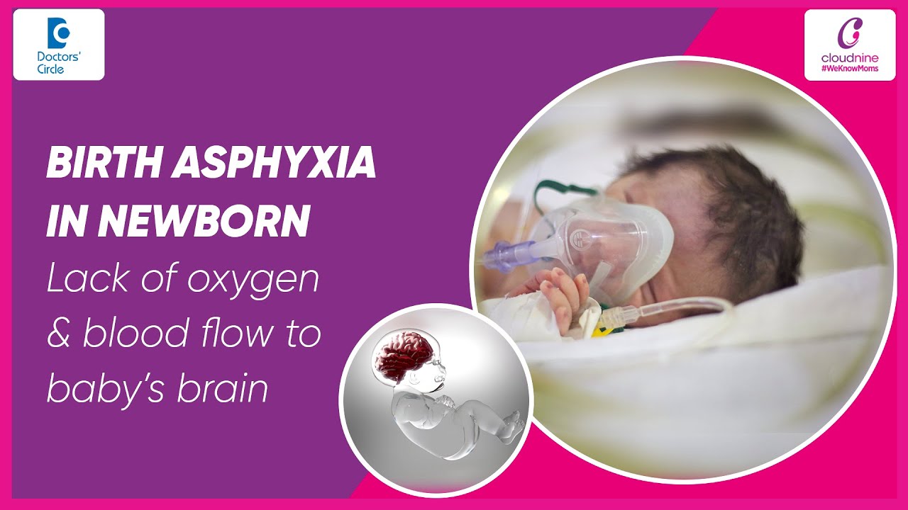 Birth Asphyxia | Low Oxygen to Baby's Brain | Birth #asphyxia in # ...