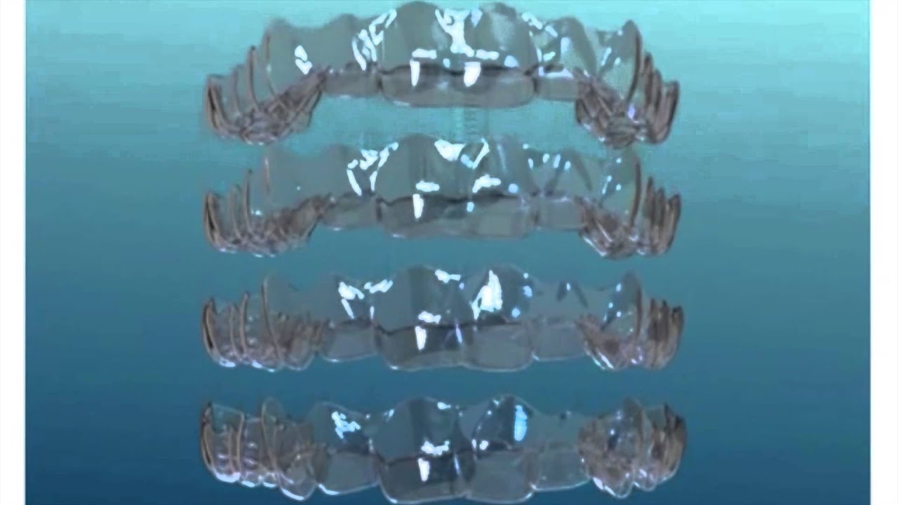 04 Invisalign digital animation - YouTube