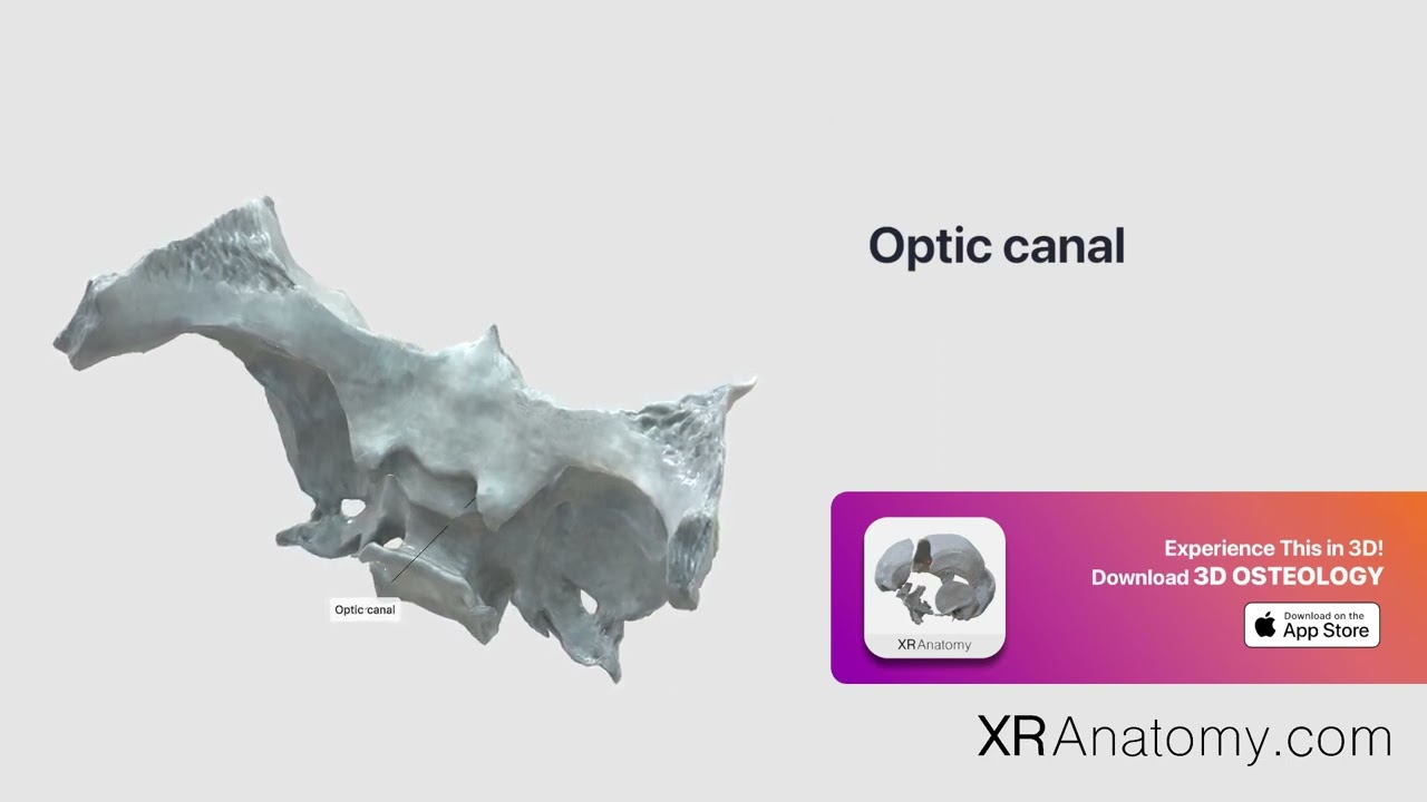 Optic Canal Sphenoid Bone