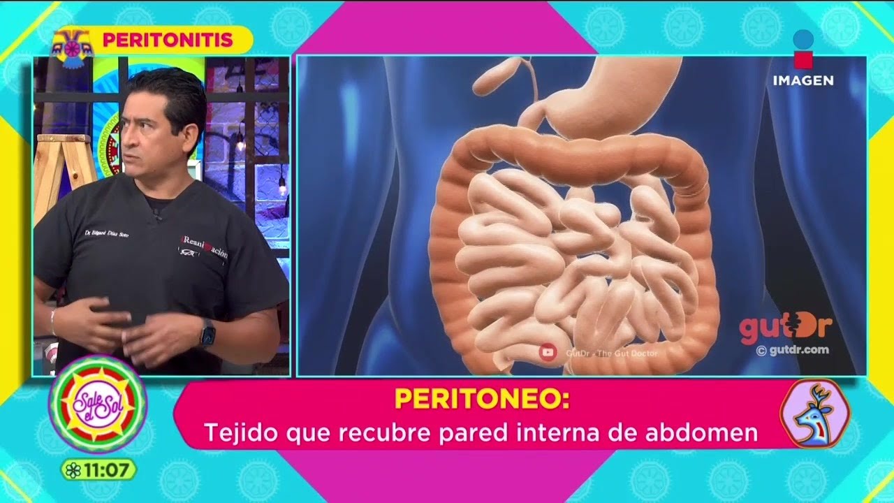 Todo sobre la Peritonitis: síntomas, causas y más | Visita de Doctor ...