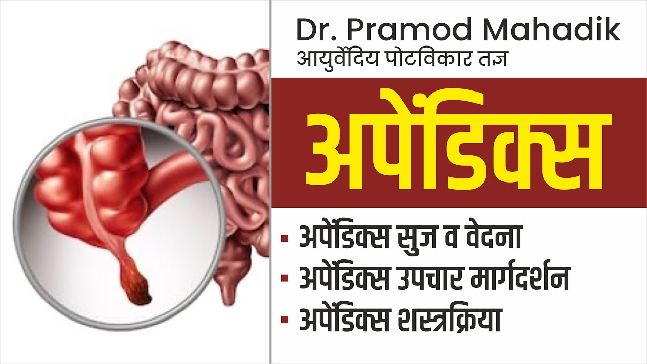 Appendix | सूज| वेदना | opration समजून घेऊया डॉ. प्रमोद महाडीक ...