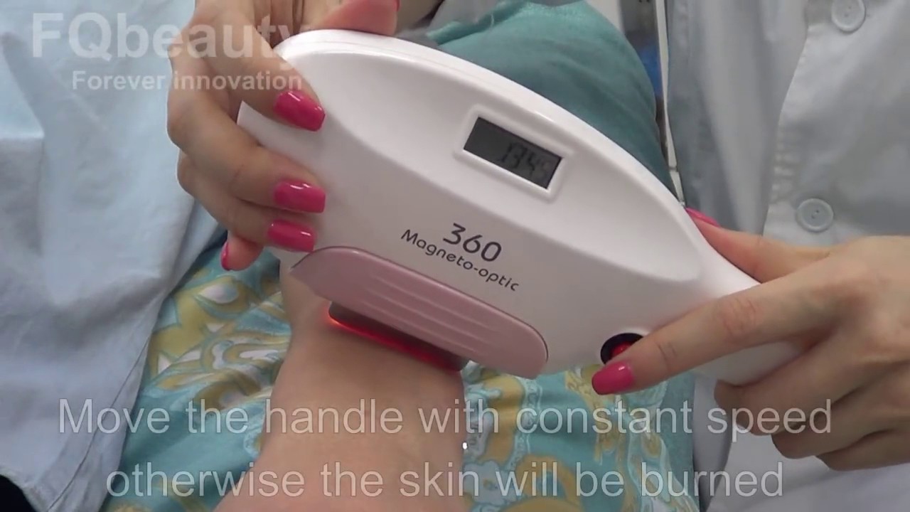 360 magneto-optical hair removal machine - YouTube
