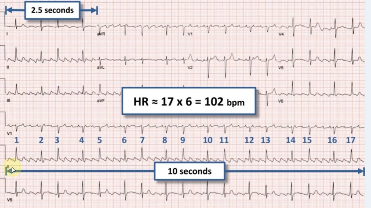 10 Second Rule - YouTube