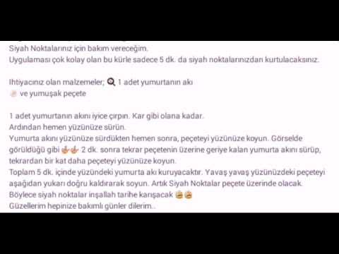 Üzünüzdeki qara nöqtəlerden qurtulmagin en asand yolu
