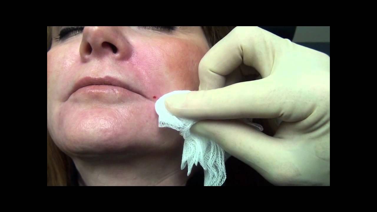 LaViv Injection - YouTube