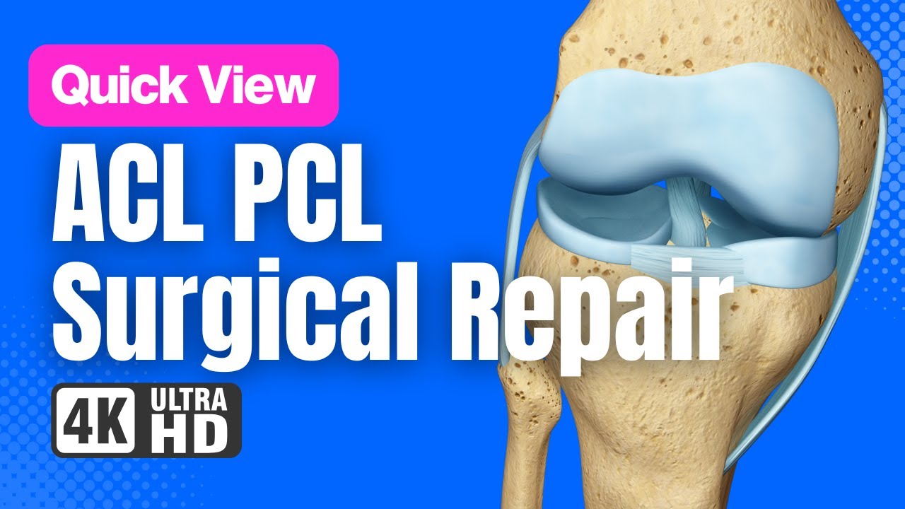 ACL PCL Surgical Reconstruction // See How It Works // 3D Animation ...