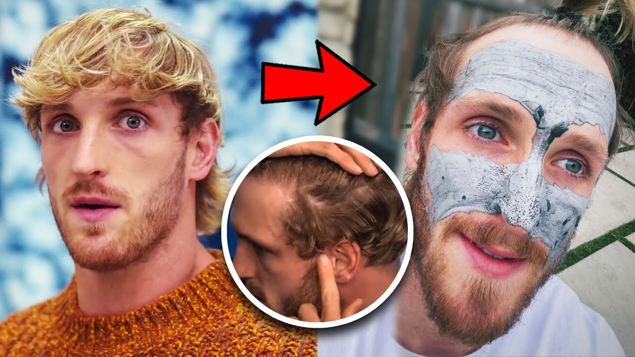 Logan Paul Proves He Didn't Get A Hair Transplant? - YouTube