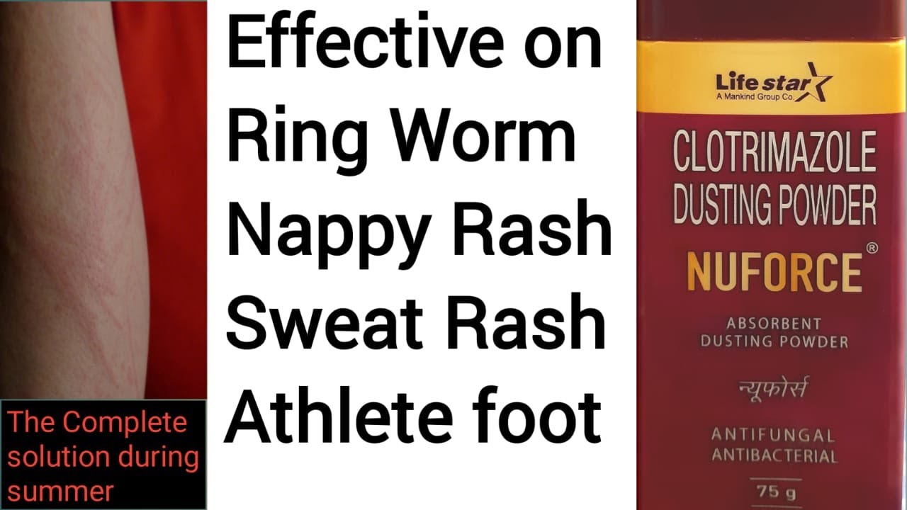 Clotrimazole Dusting Powder Review | Ghamori ke liye Powder | Ghamori ...