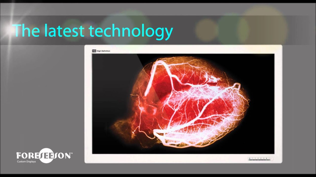 FSN displays overview 915 - YouTube