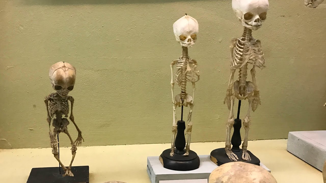 Human skeleton newborn baby - National museum of Natural History of NAS ...