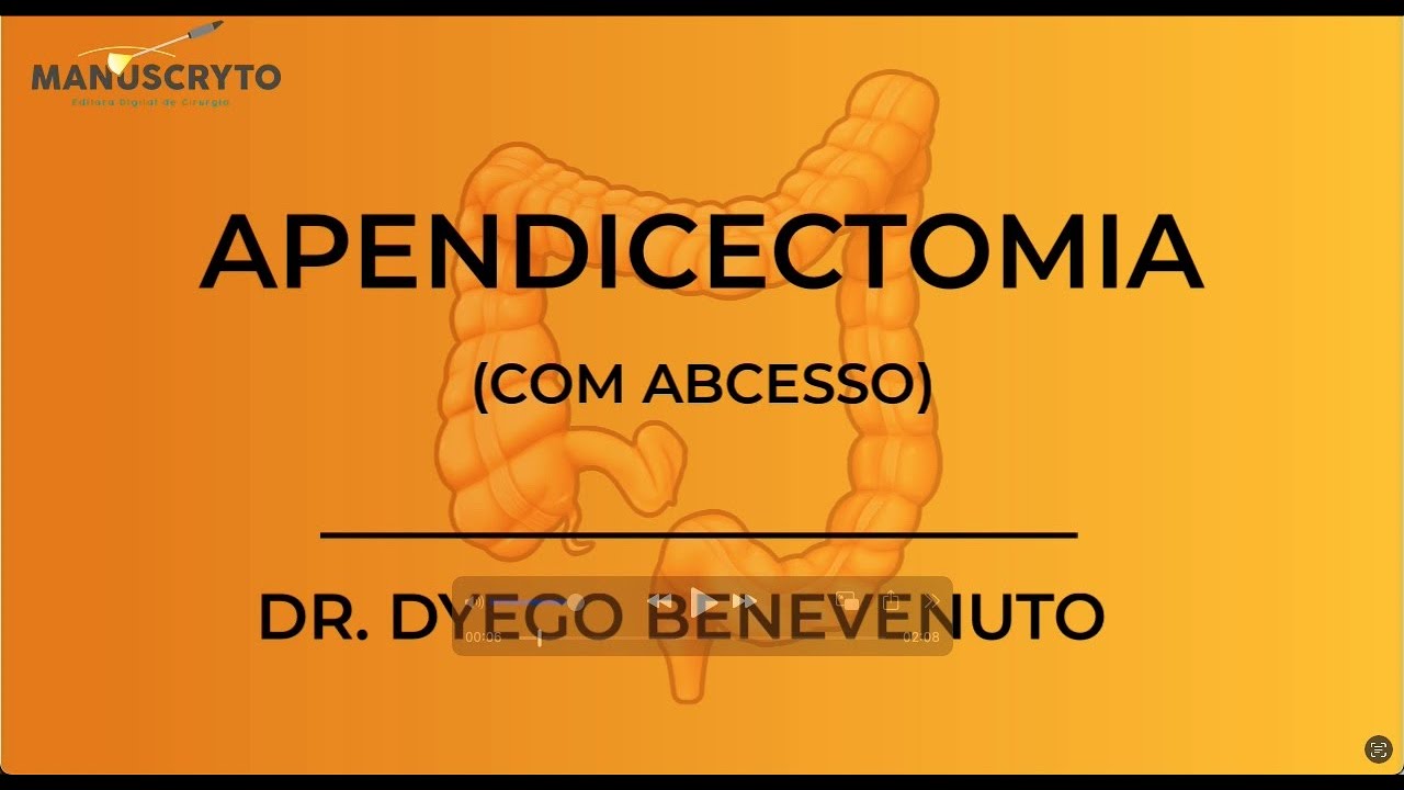 Incisao De Apendicectomia Aberta