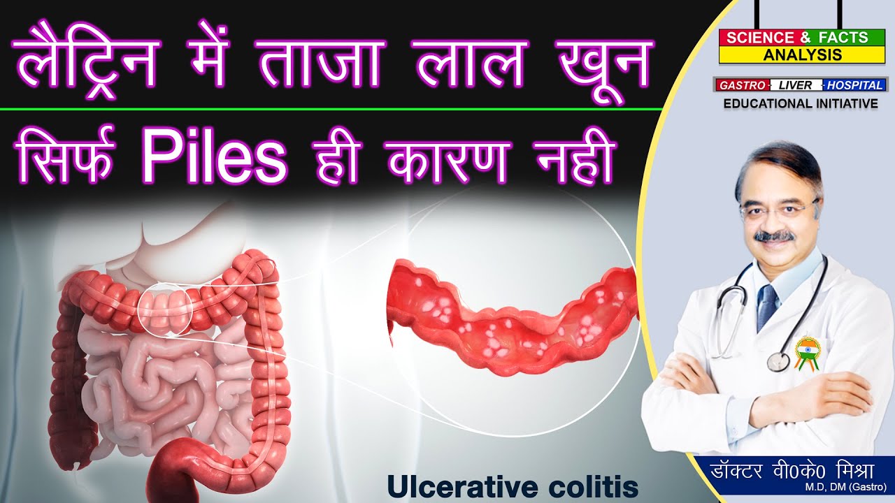 लैट्रीन में ताजा लाल खून सिर्फ Piles ही कारण नहीं || WHAT DISEASE ...