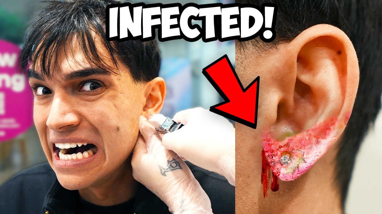 I got my ear pierced and THIS HAPPENED.. *GROSS WARNING* - YouTube