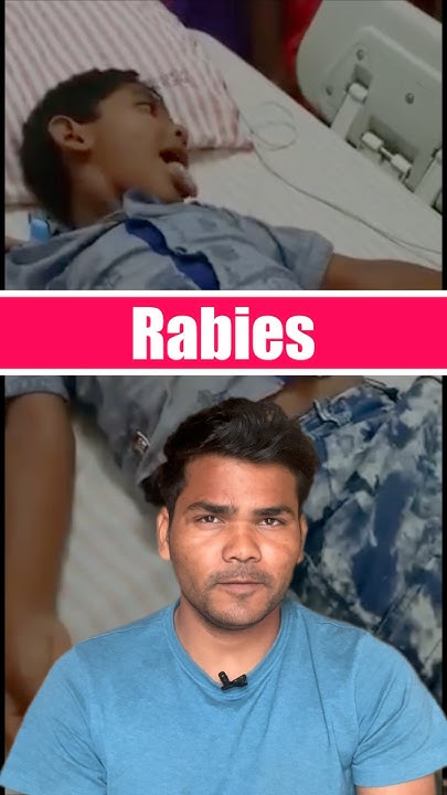 Rabies patients #shorts - YouTube