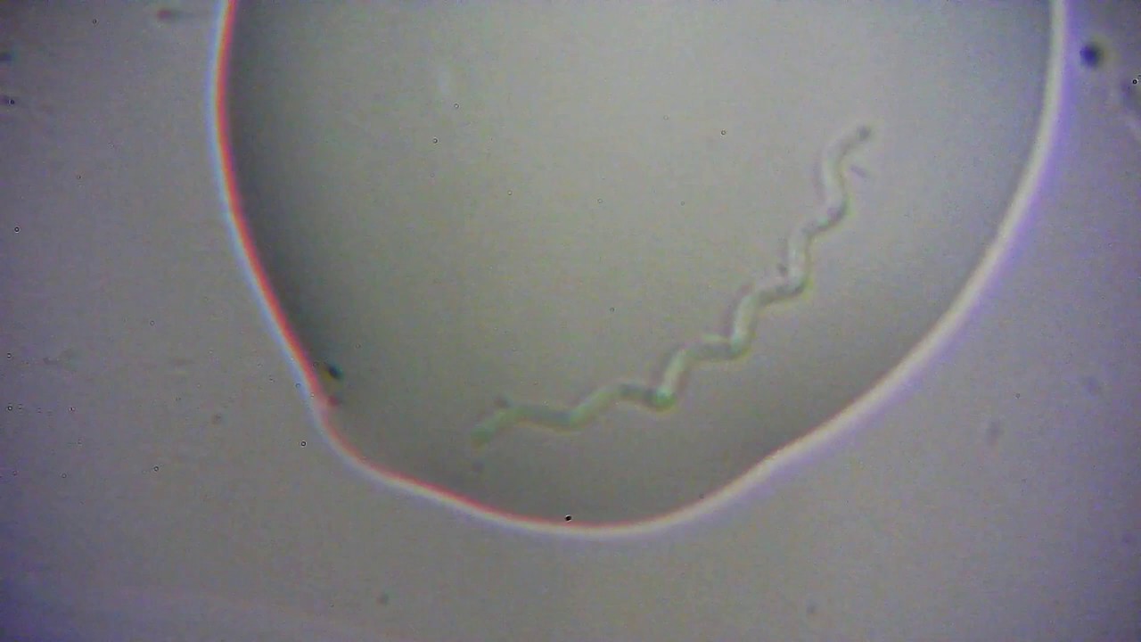 Incredible Footage Of Spirochete Bacteria 2500X - YouTube