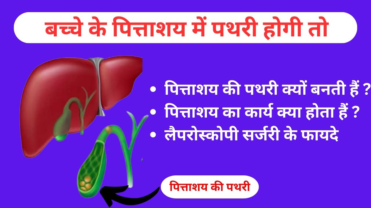 बच्चो में पित्ताशय की पथरी होने पे क्या इलाज होता है | Pittashay ki ...