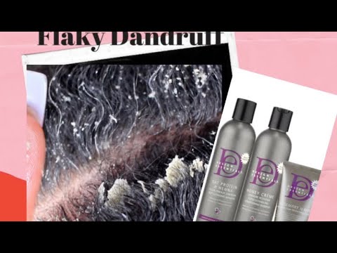 QUARANTINE DANDRUFF W/BRAIDS USING DESIGN ESSENTIALS HAIR PRODUCTS ...