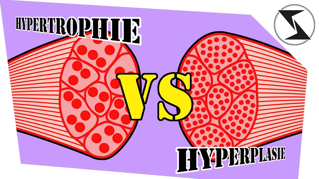 Hypertrophie vs. Hyperplasie - Aufklärung im Muskelaufbau - YouTube