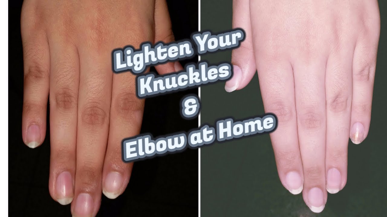 How to Lighten Dark Elbows & Knuckles at Home (DIY Beauty Hacks ...